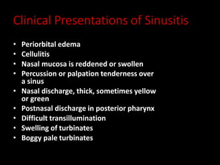 Sinusitis.pptx