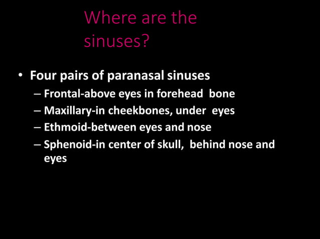 Sinusitis.pptx