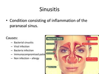 sinusitis.pptx