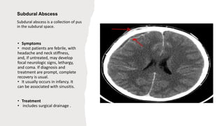 different complications of sinusitis.pptx