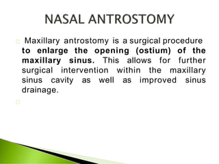 SINUSITIS (1).pptx