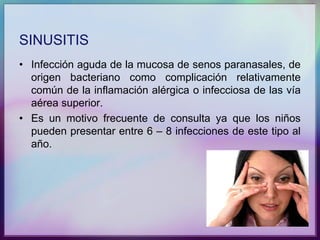 Sinusitis aguda | PPTX
