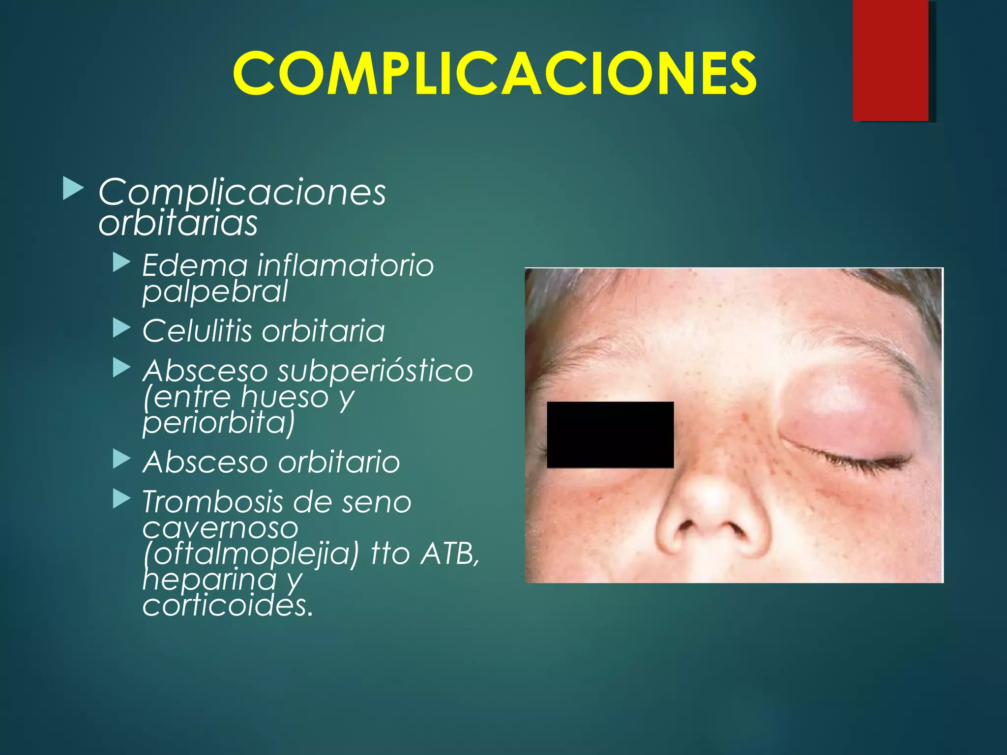 SINUSITIS EN NIÑOS-DR. OMAR GONZALES SUAZO | PPT