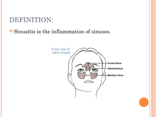 Sinusitis in children | PPT