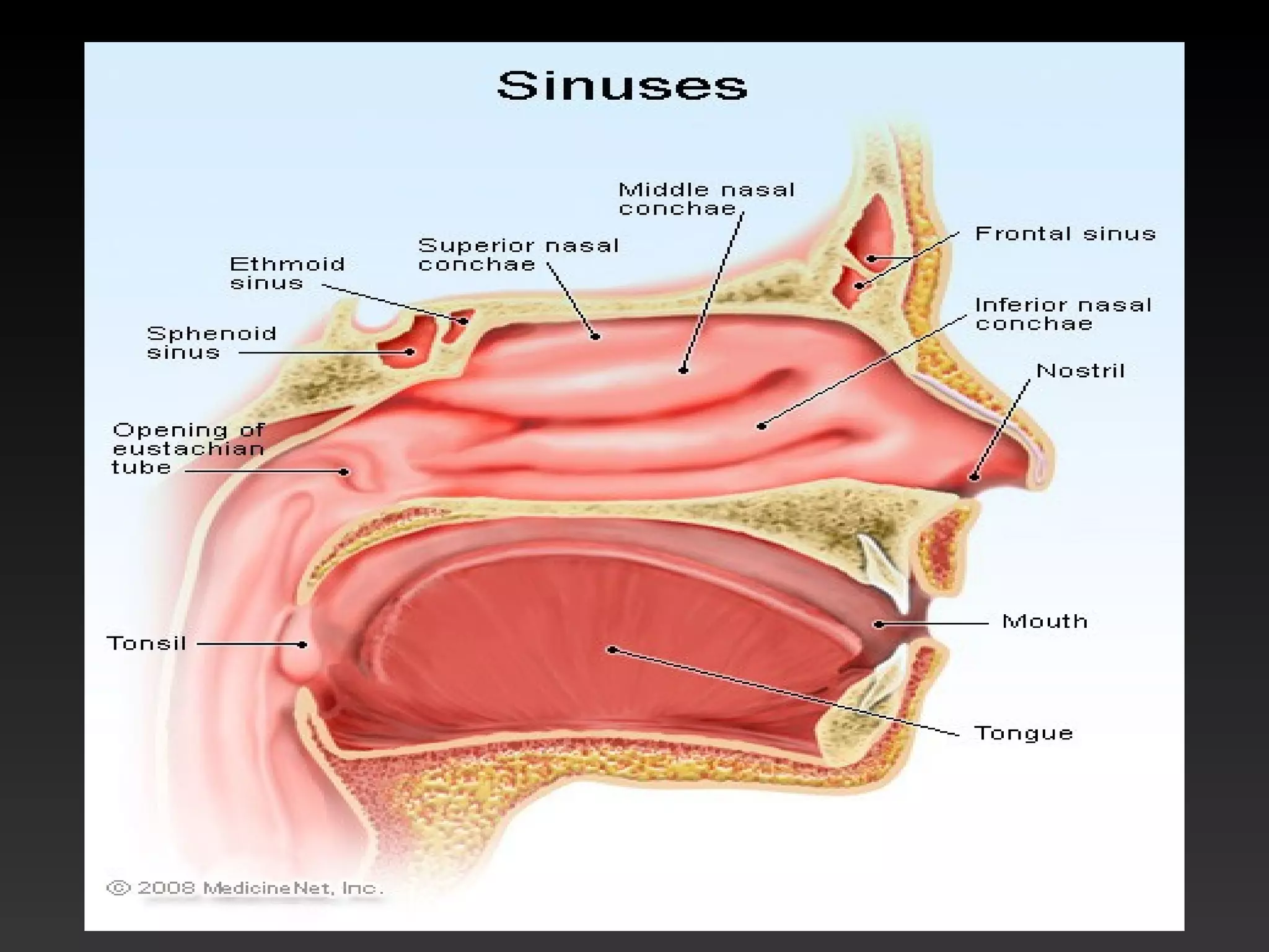 Sinusitis jamur fix | PPT