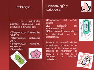 Sinusitis pediatria | PPTX