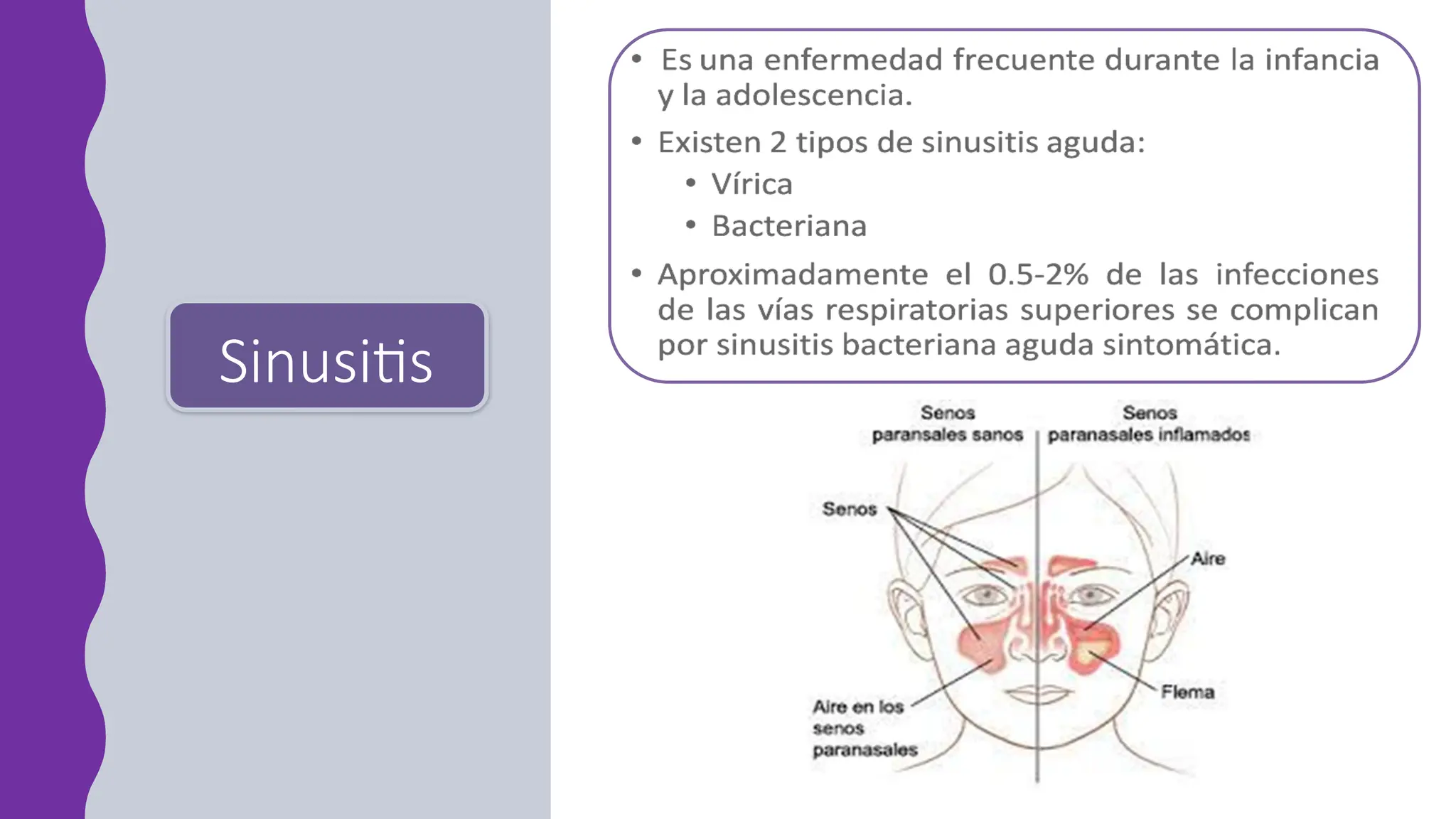 que es la sinusitis pediatria etiologia y diagnostio | PPTX
