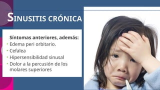 sinusitis pediátricapresentacion de otorrinolaringologia .pptx