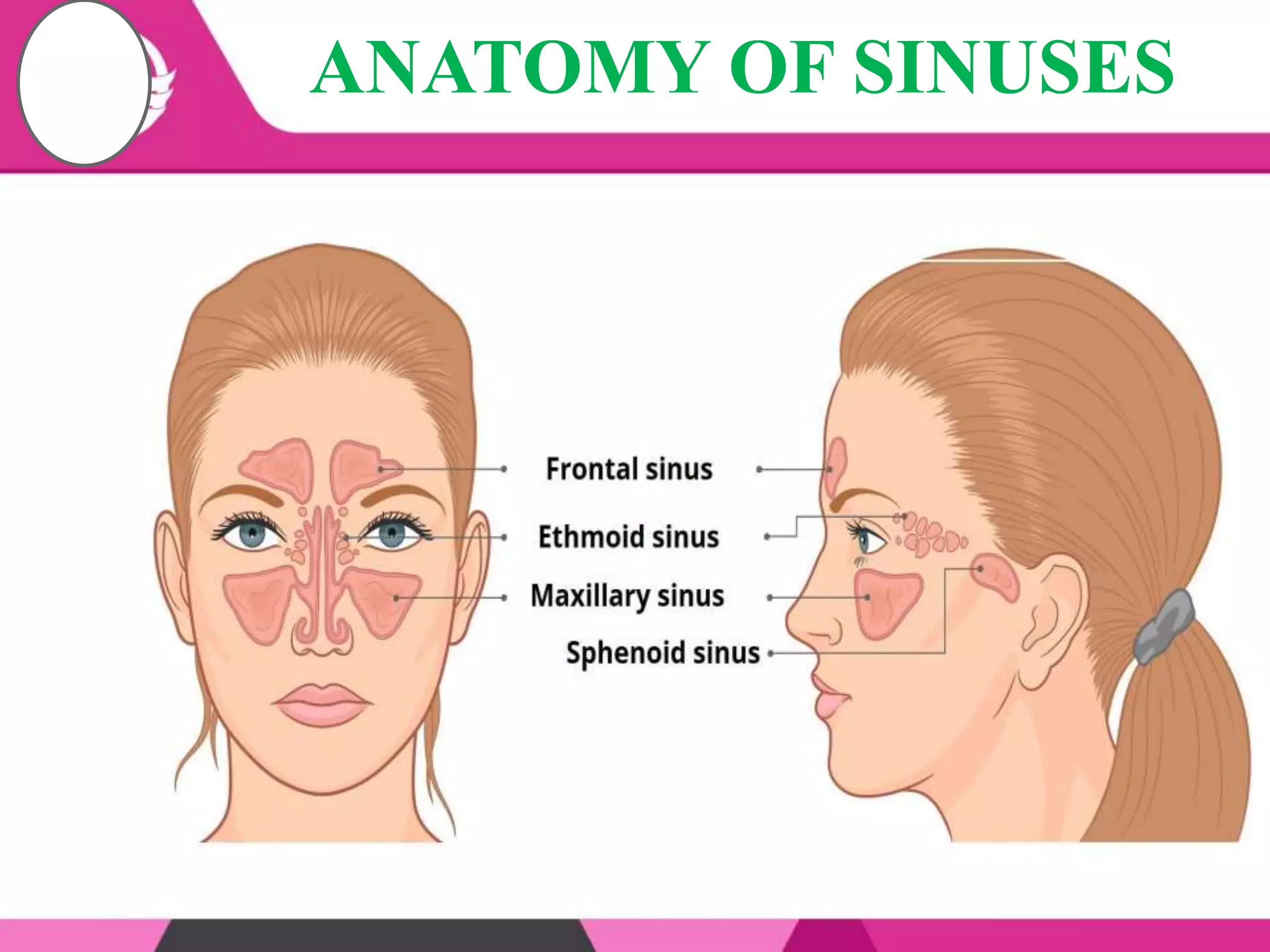 SINUSITIS PPT.pptx