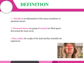 SINUSITIS PPT.pptx