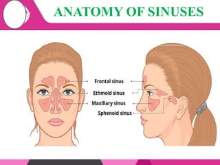 SINUSITIS PPT.pptx