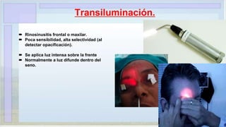 sinusitis cuadro clinico fisiologia, diagnostico y su tratamiento | PPTX
