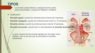 SINUSITIS Y POLIPOS NASALESvcvcvvvvvvvvvvvvvv | PPTX