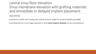 Sinus floor elevation | PPTX