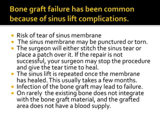 Sinus lift and its alternatives-pterygoid implants and basal implants ...