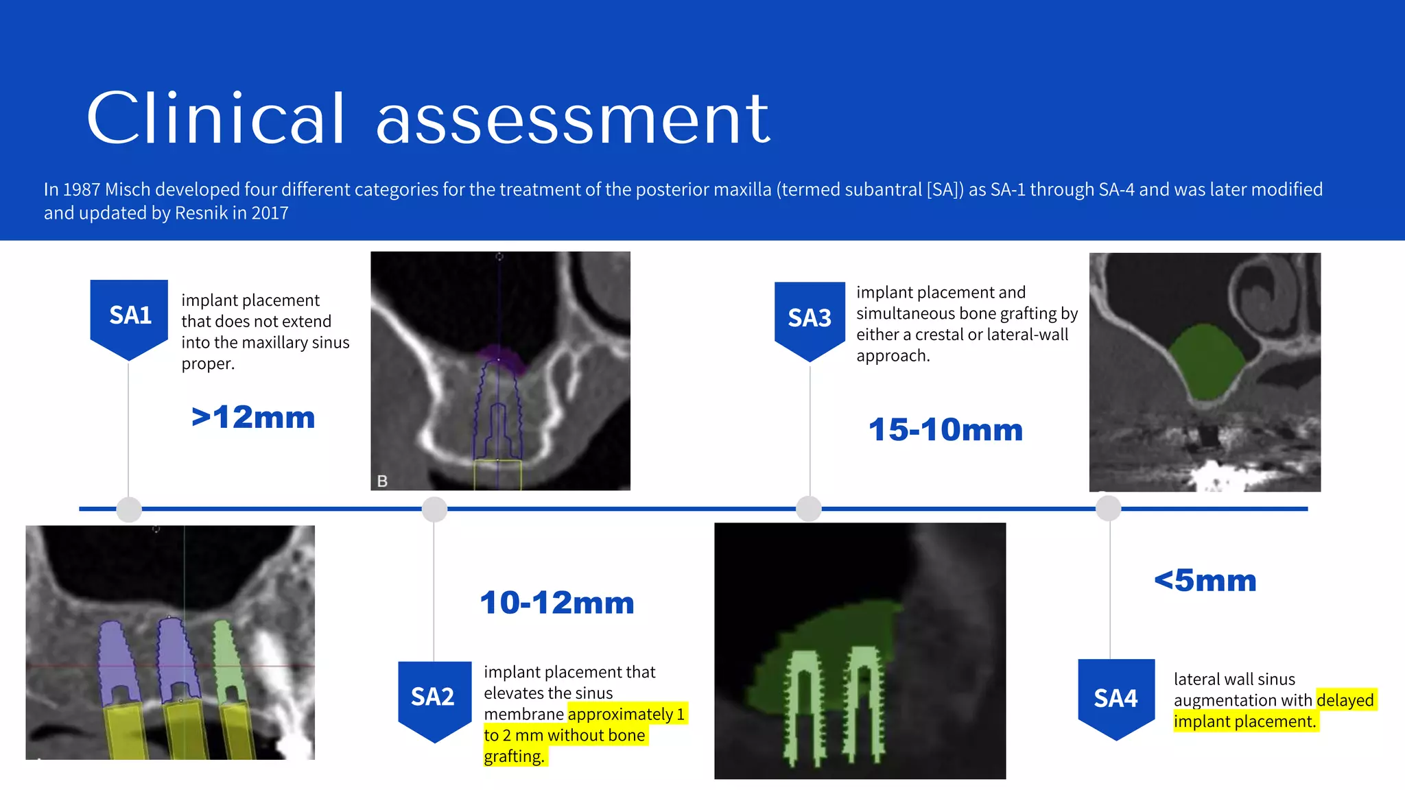 sinus lift | PPTX
