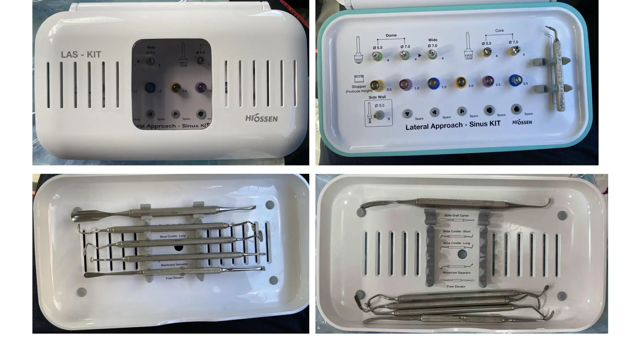 Sinus Lift illustration (step by step procedure).pdf