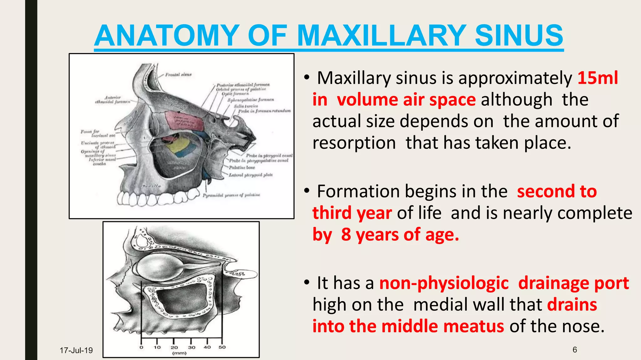 "Sinus Lift in Implant Dentistry" | PPTX