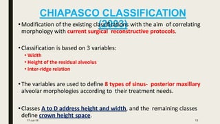 "Sinus Lift in Implant Dentistry" | PPTX