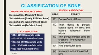 "Sinus Lift in Implant Dentistry" | PPTX