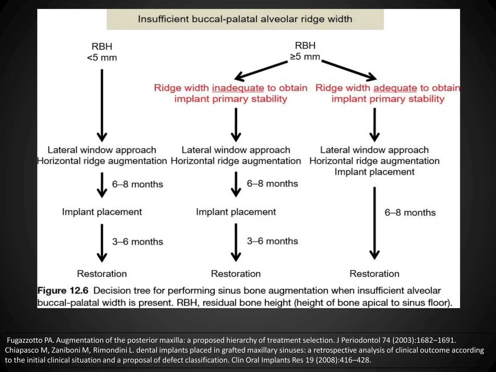 Sinus Lift ppt about maxillary sinus lift | PDF
