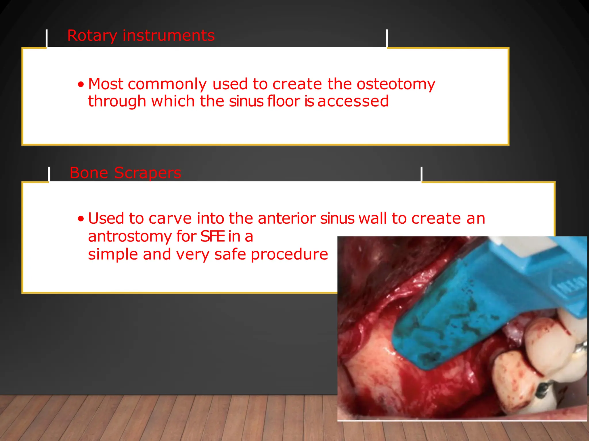 Sinus Lift ppt about maxillary sinus lift | PDF