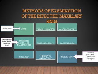 Sinus Lift ppt about maxillary sinus lift | PDF
