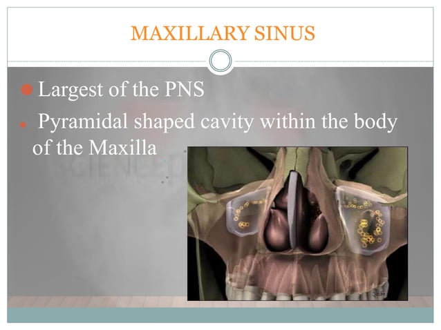 Sinus Lift ppt about maxillary sinus lift | PDF