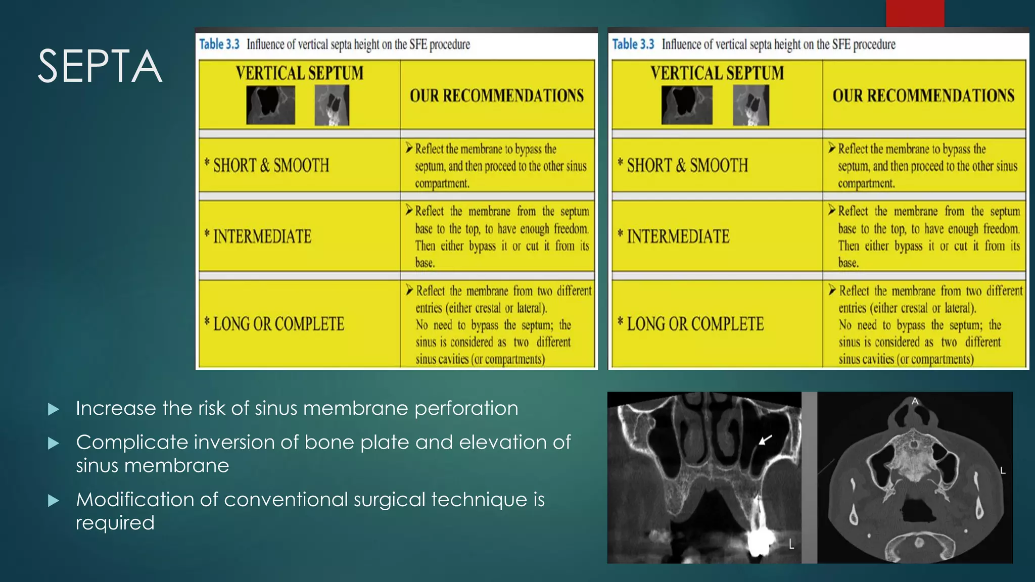 Sinus lift procedures.pptx