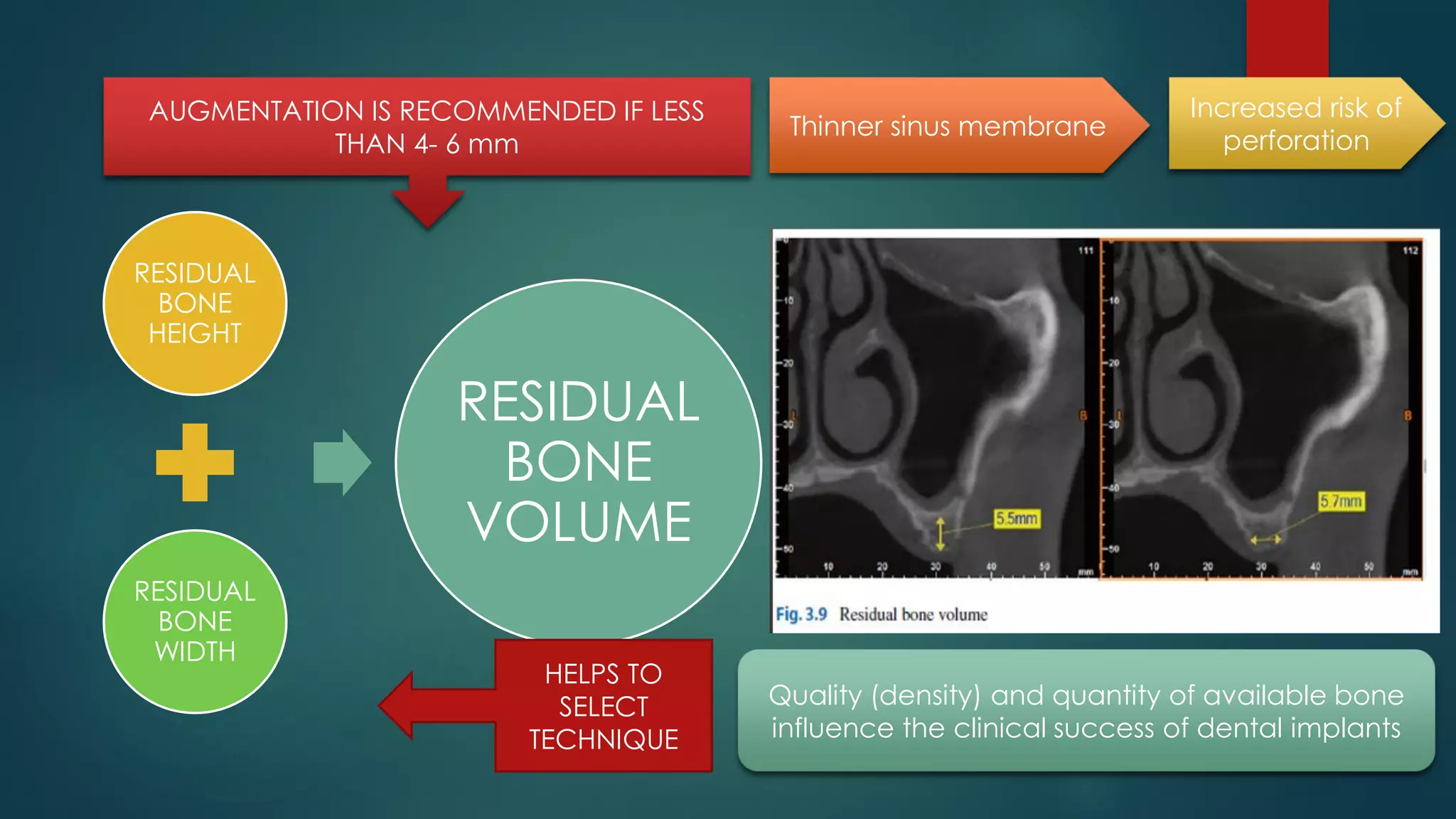 Sinus lift procedures.pptx