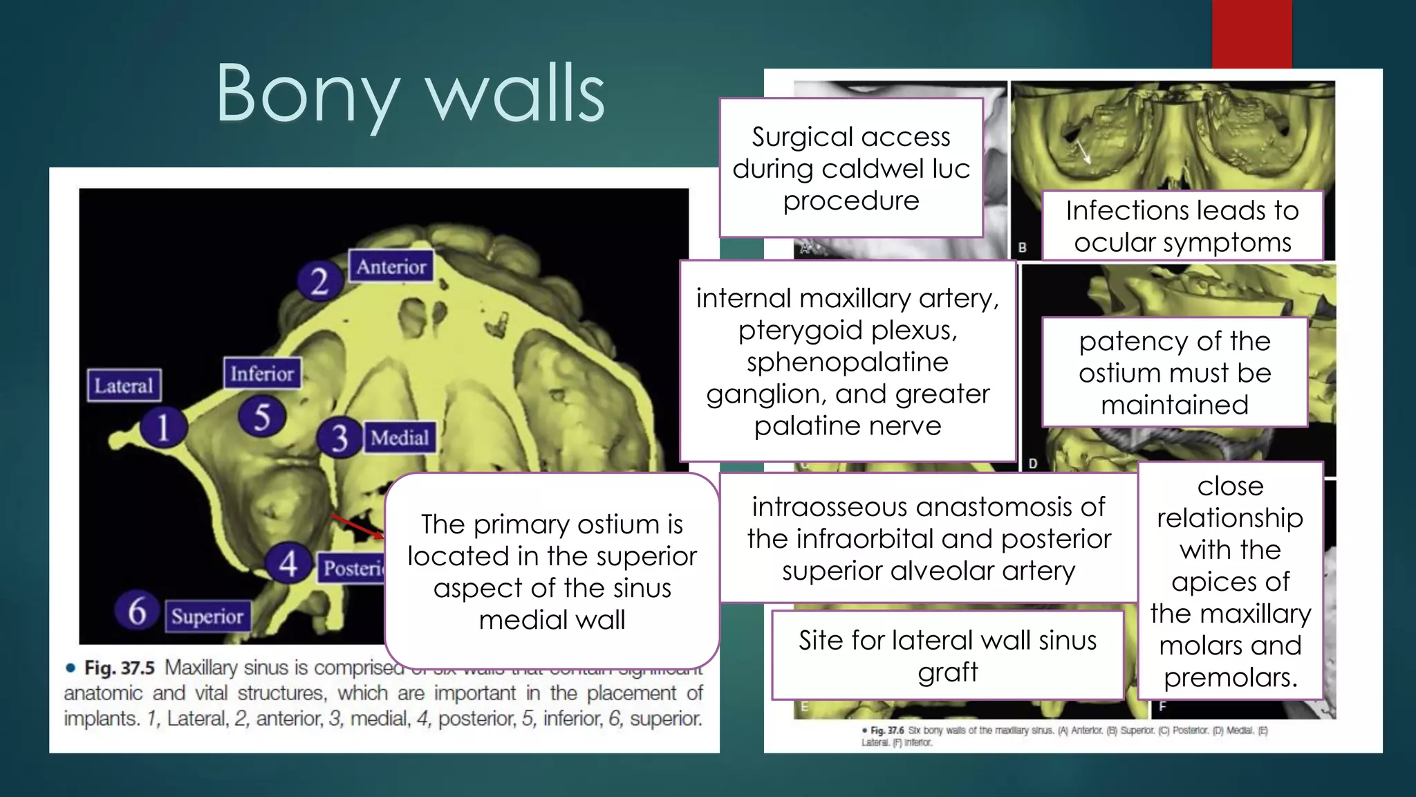 Sinus lift procedures.pptx