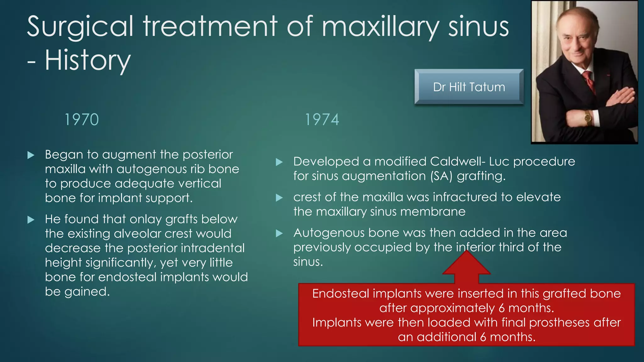 Sinus lift procedures.pptx