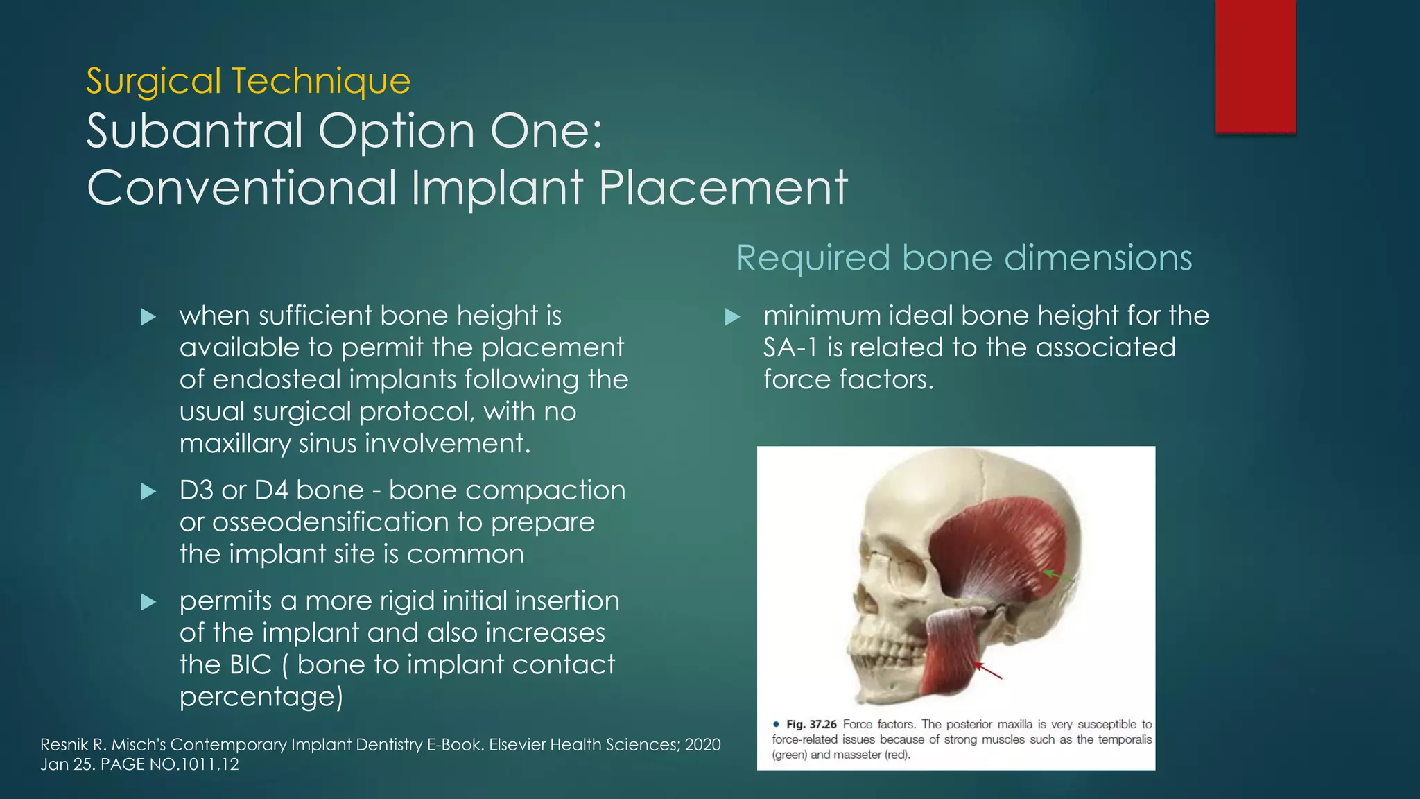 Sinus lift procedures.pptx