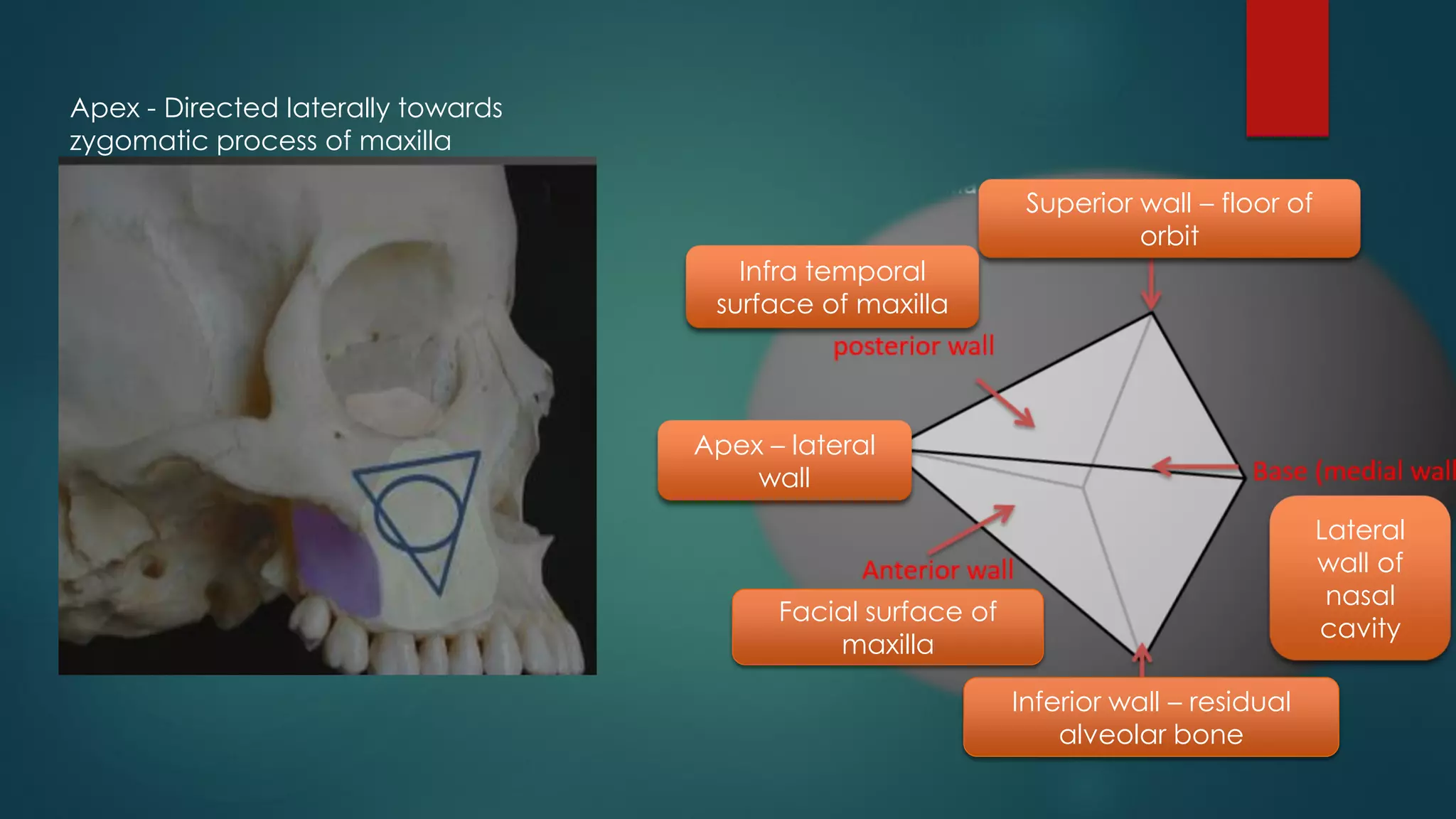 Sinus lift procedures.pptx