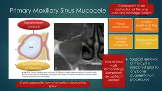 Sinus lift procedures.pptx