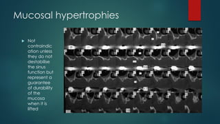 Sinus lift procedures.pptx