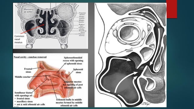 Sinus lift procedures.pptx