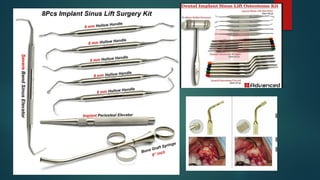 Sinus lift procedures.pptx