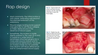 Sinus lift procedures.pptx