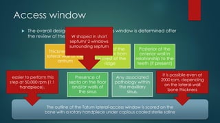 Sinus lift procedures.pptx