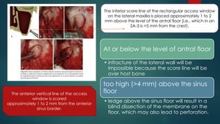 Sinus lift procedures.pptx
