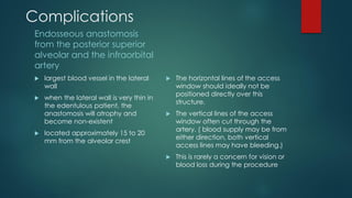 Sinus lift procedures.pptx