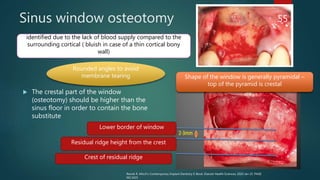 Sinus lift procedures. final copy of presentation pptx | PPTX