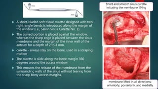 Sinus lift procedures. final copy of presentation pptx | PPTX