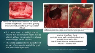 Sinus lift procedures. final copy of presentation pptx | PPTX