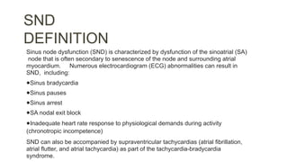 Sinus Node Dysfunction by Raashed Ramzan | PPT