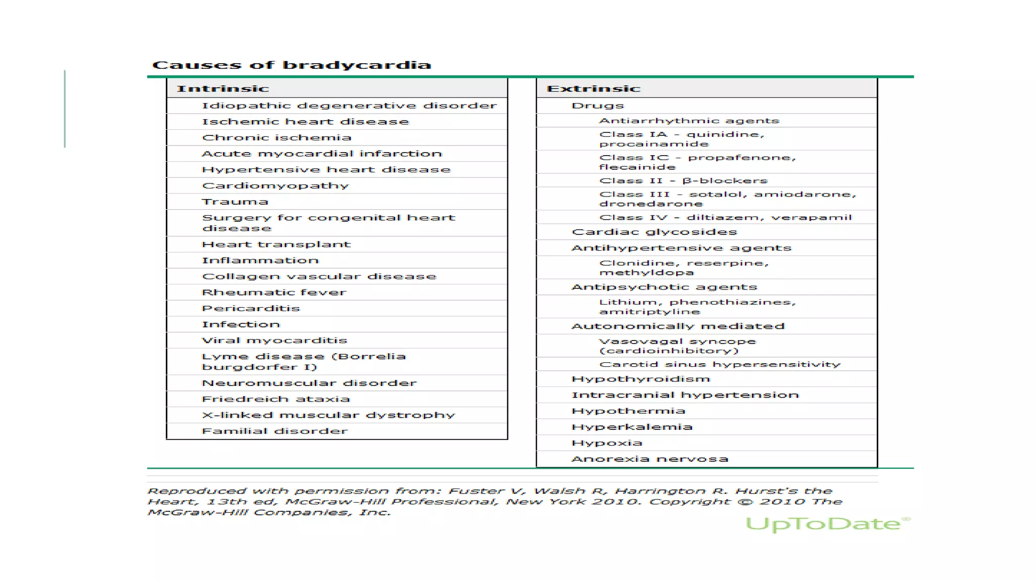 Sinus Node Dysfunction Pptx