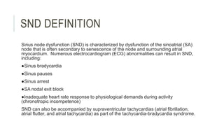Sinus node dysfunction | PPTX