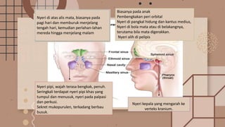SINUS PARANASAL.pptx