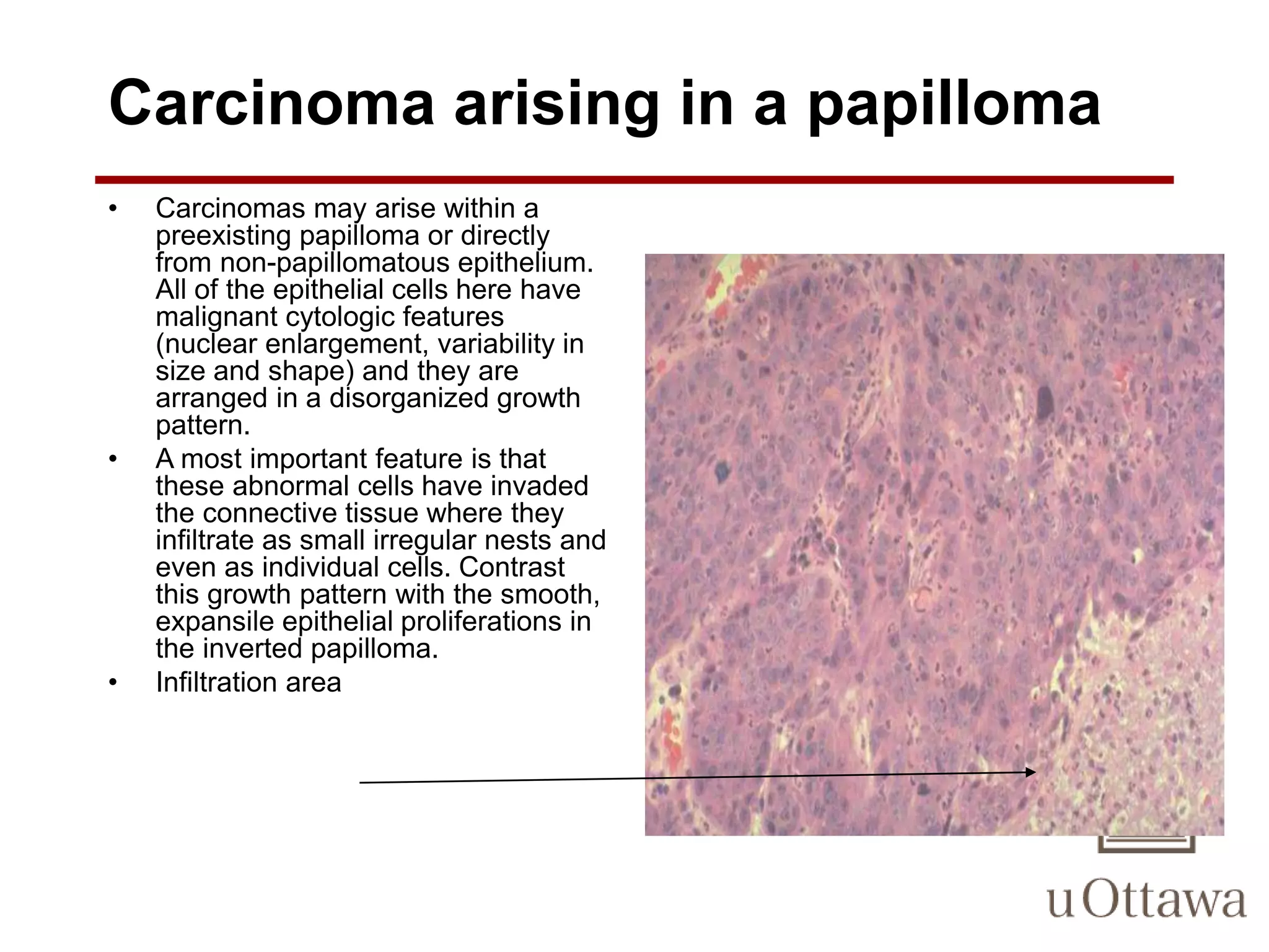 Sinus Pathology.ppt
